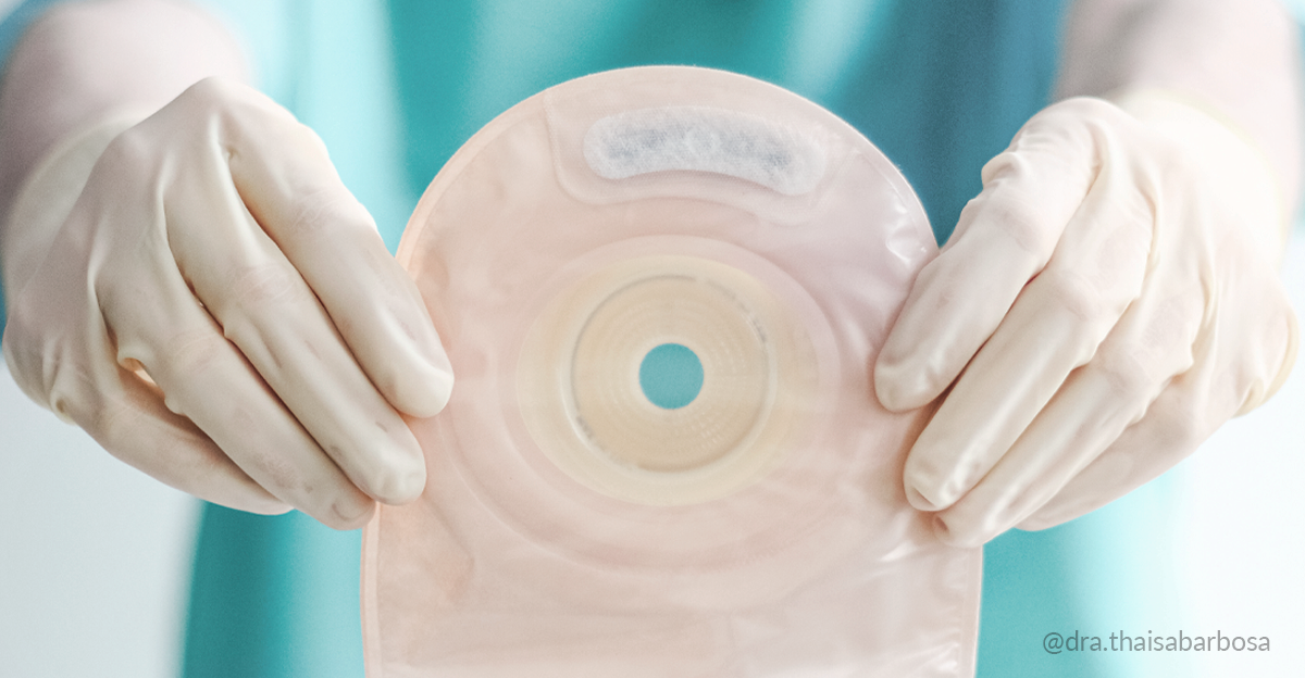 As intervenções que salvam vidas: ileostomia e colostomia - IMCCORE
